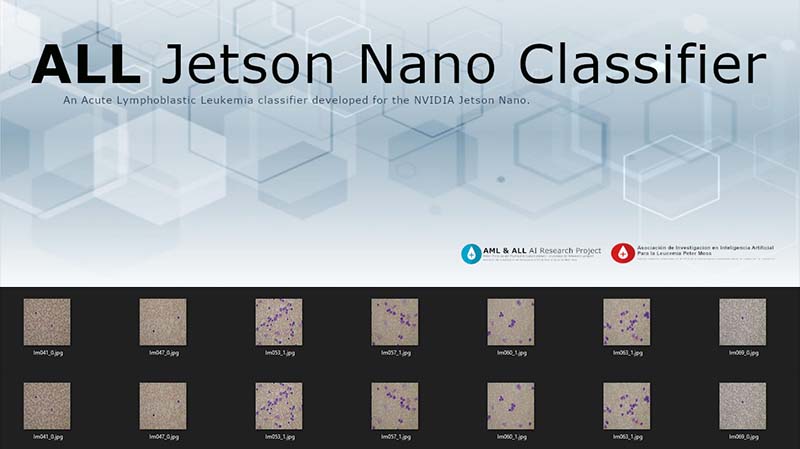 Acute Lymphoblastic Leukemia Classification with Jetson Nano | NVIDIA ...
